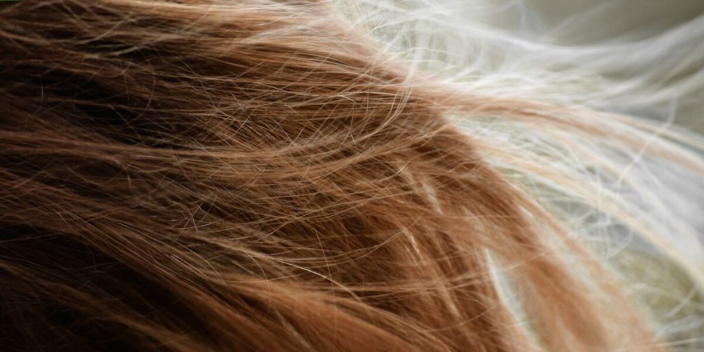 Hair Loss After Radiation Treatment: Understanding and Managing the ...