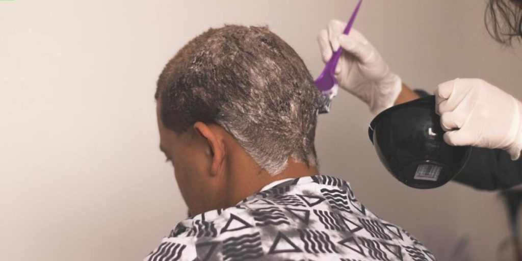 Hair Loss After Radiation Treatment: Understanding and Managing the ...